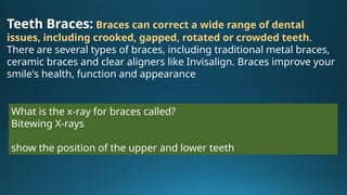 the radiographia appearance of different dental materials.pptx