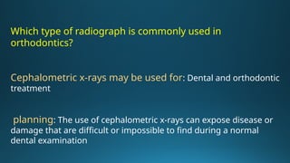 the radiographia appearance of different dental materials.pptx