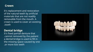 the radiographia appearance of different dental materials.pptx
