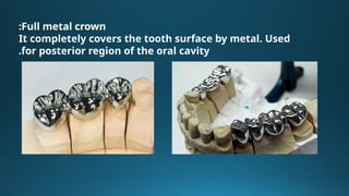the radiographia appearance of different dental materials.pptx