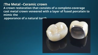 the radiographia appearance of different dental materials.pptx