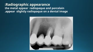 the radiographia appearance of different dental materials.pptx