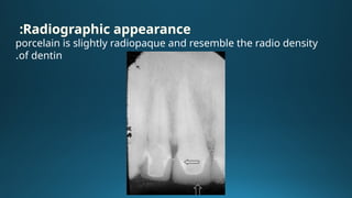 the radiographia appearance of different dental materials.pptx