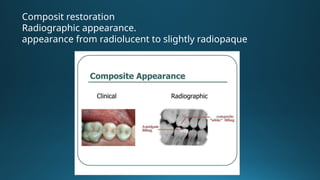 the radiographia appearance of different dental materials.pptx