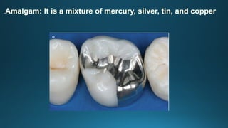 the radiographia appearance of different dental materials.pptx