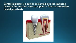 the radiographia appearance of different dental materials.pptx