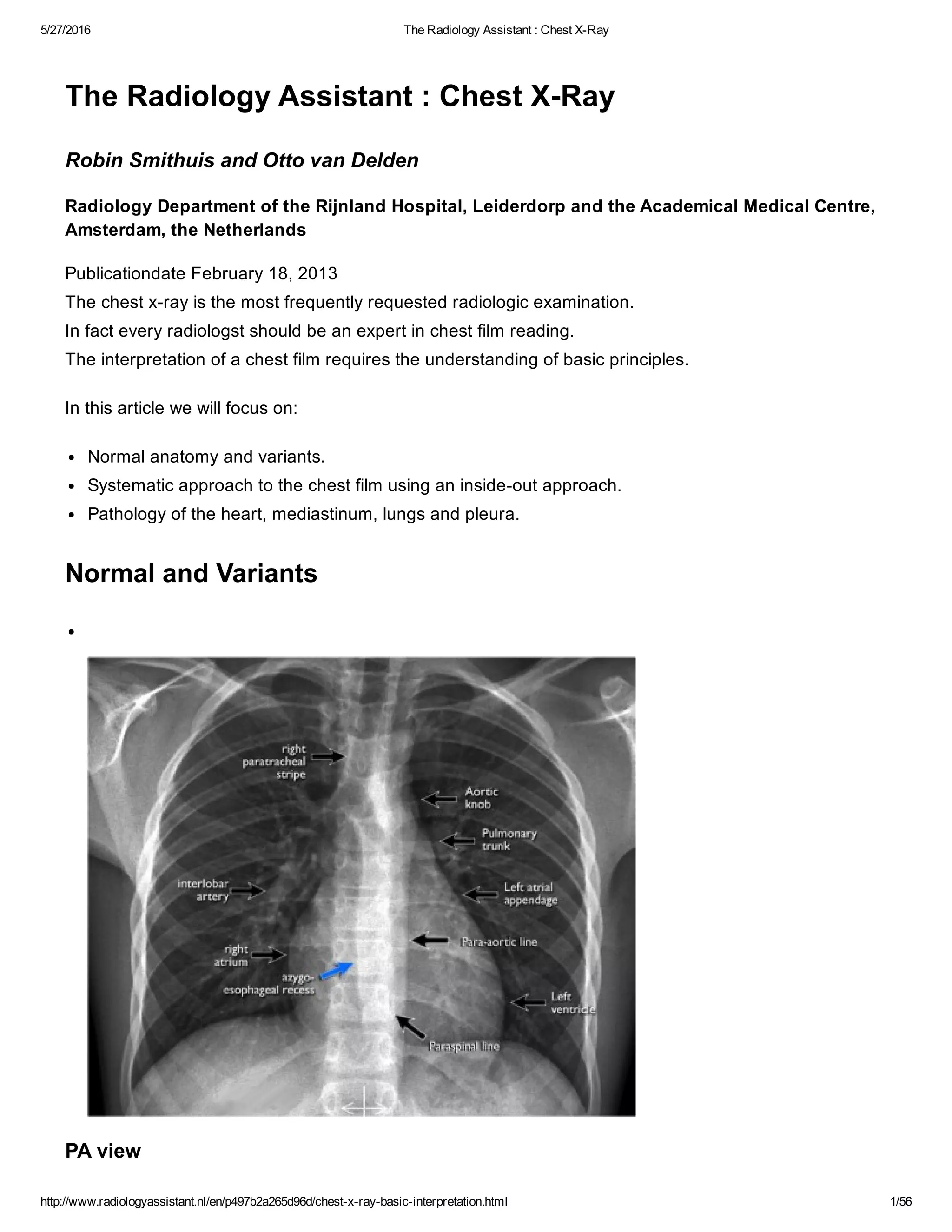The Radiology Assistant Chest X Ray Basic Interpretation