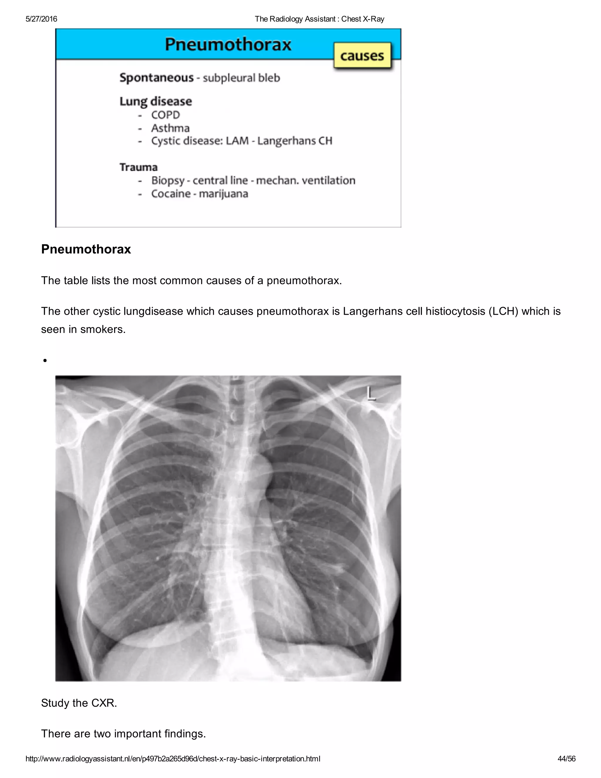 The radiology assistant chest x ray - basic interpretation | PDF