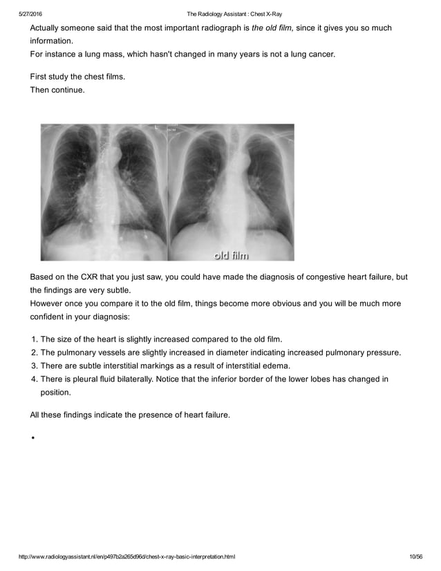 The radiology assistant chest x ray - basic interpretation | PDF