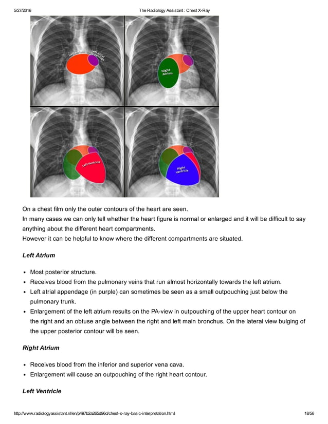 The radiology assistant chest x ray - basic interpretation | PDF