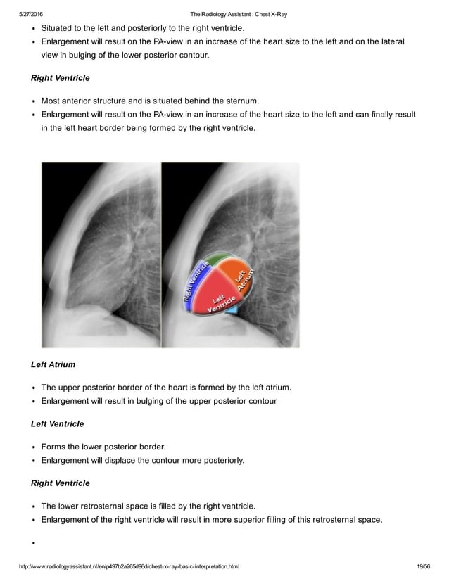 The radiology assistant chest x ray - basic interpretation | PDF