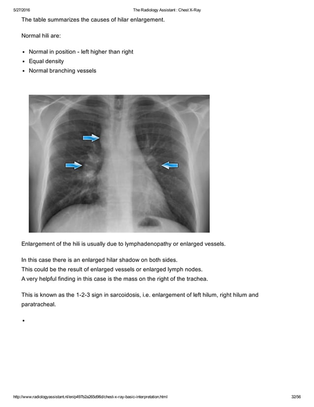 The radiology assistant chest x ray - basic interpretation | PDF