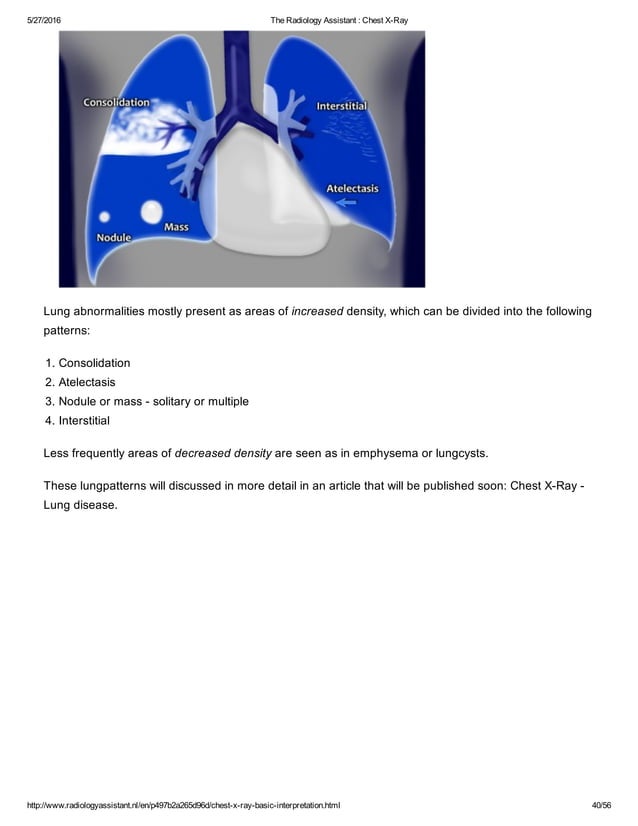 The radiology assistant chest x ray - basic interpretation | PDF