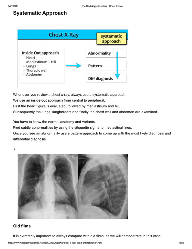 The radiology assistant chest x ray - basic interpretation | PDF