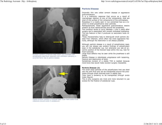 The radiology assistant hip arthroplasty | PDF