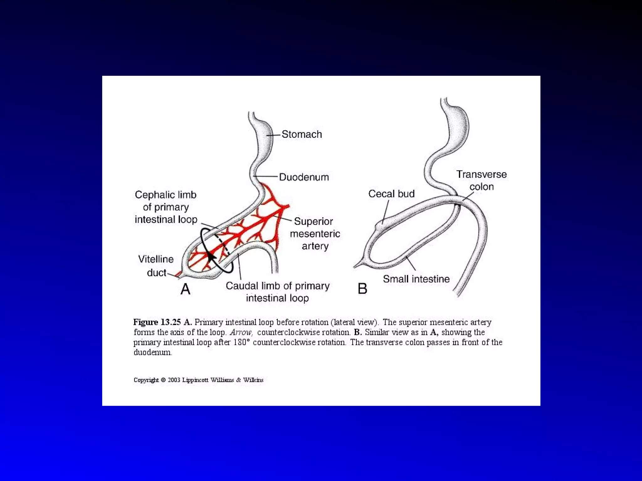 The Radiology of Malrotation | PPT
