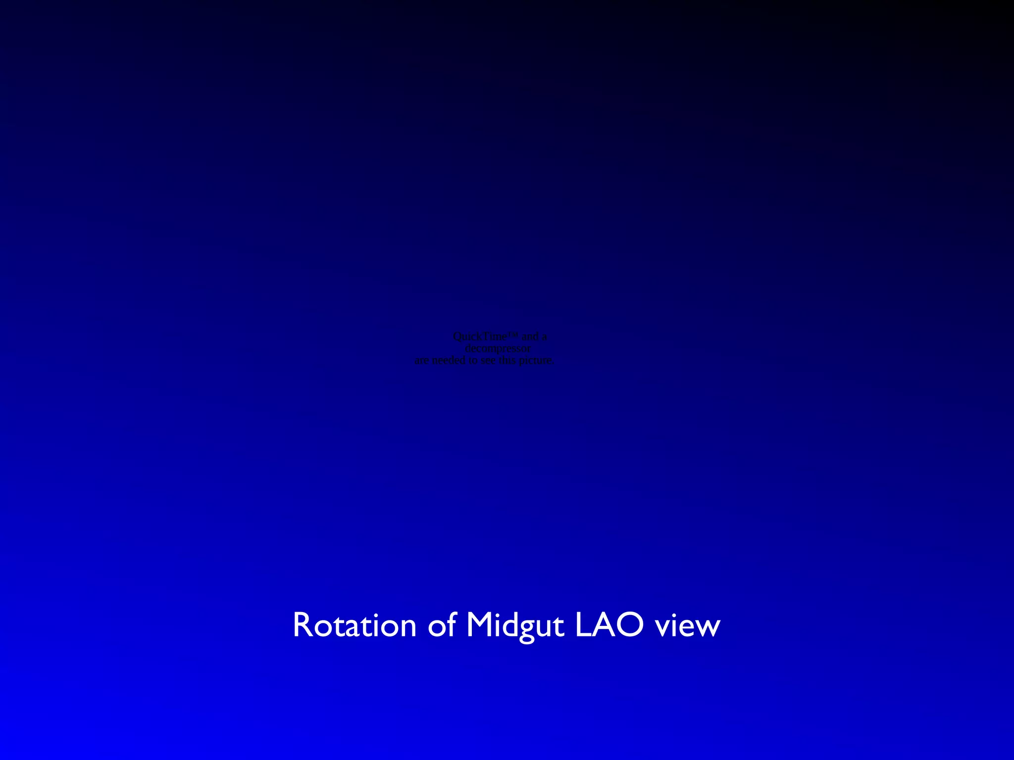 The Radiology of Malrotation | PPT