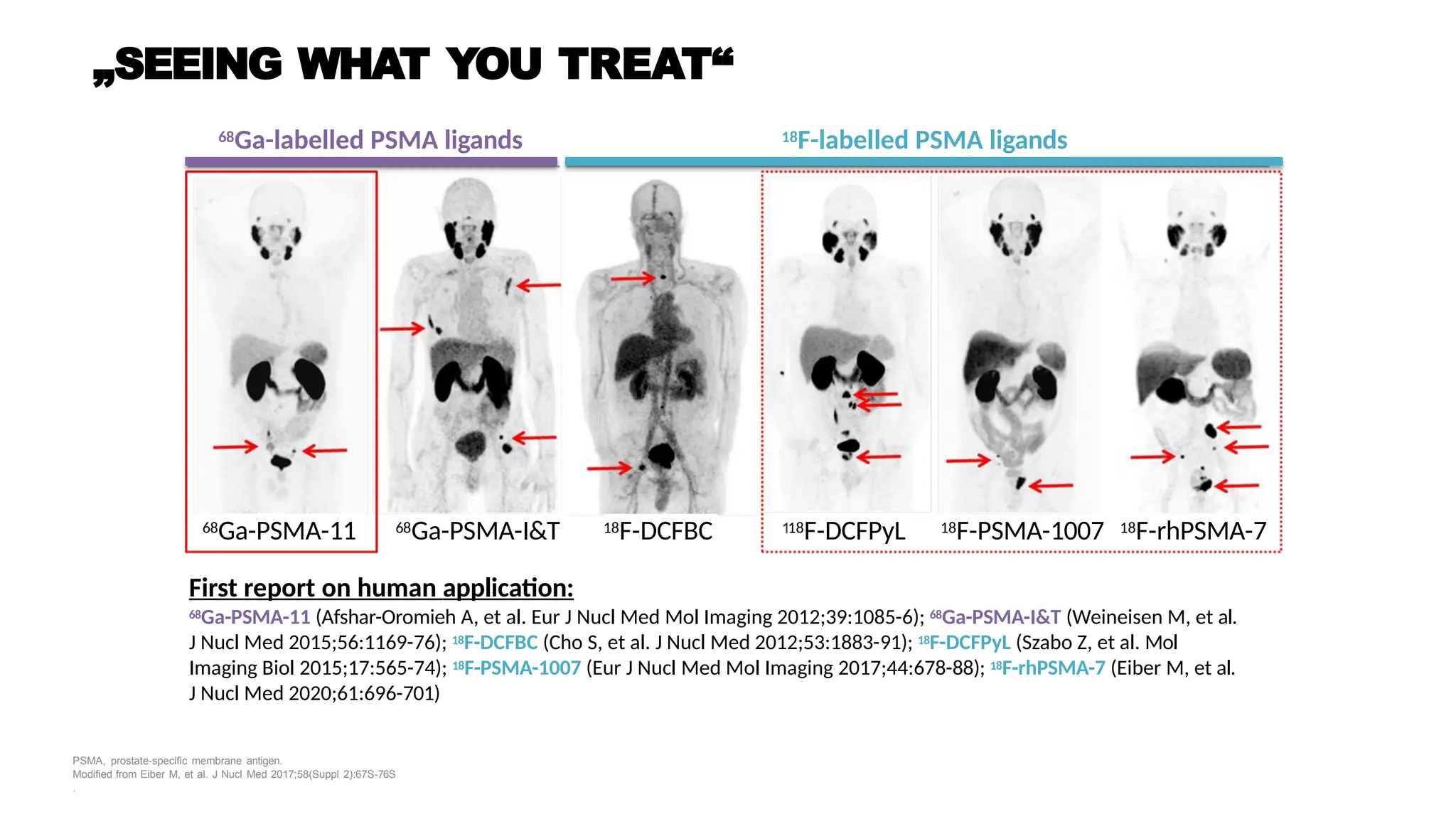 Theranostic Perspective for PSMA-positive prostate cancerpptx | PPTX