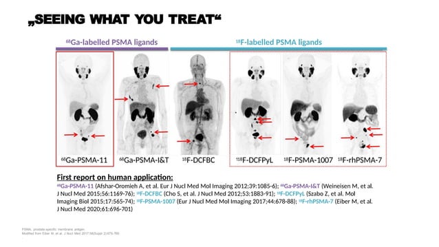 Theranostic Perspective for PSMA-positive prostate cancerpptx | PPTX ...