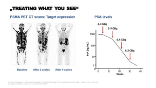 Theranostic Perspective for PSMA-positive prostate cancerpptx | PPTX