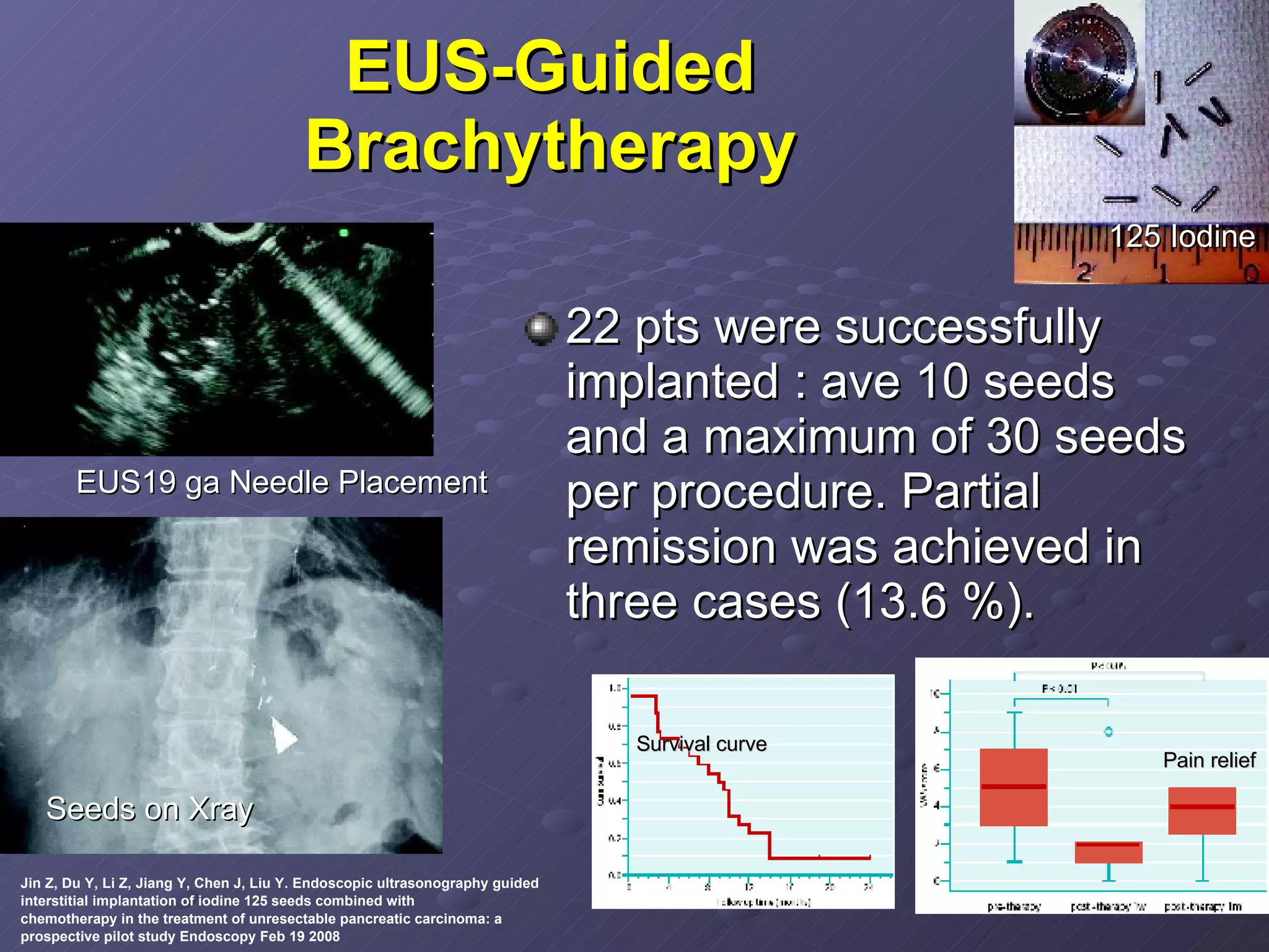 Therapeutic Eus 2008 | PPT
