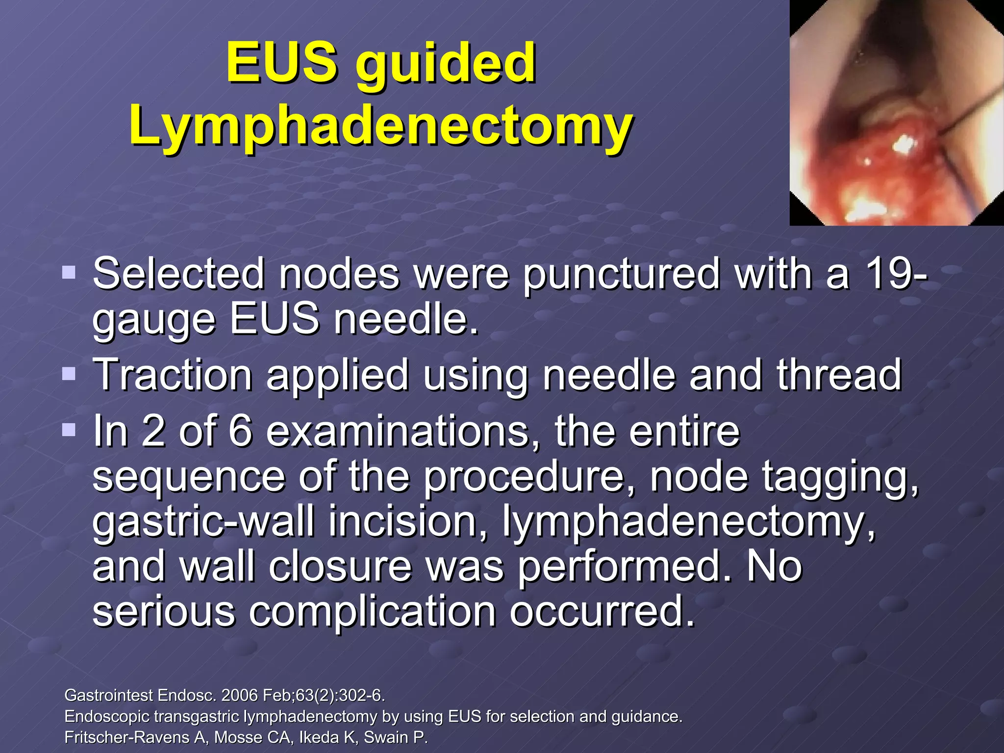 Therapeutic Eus 2008 | PPT