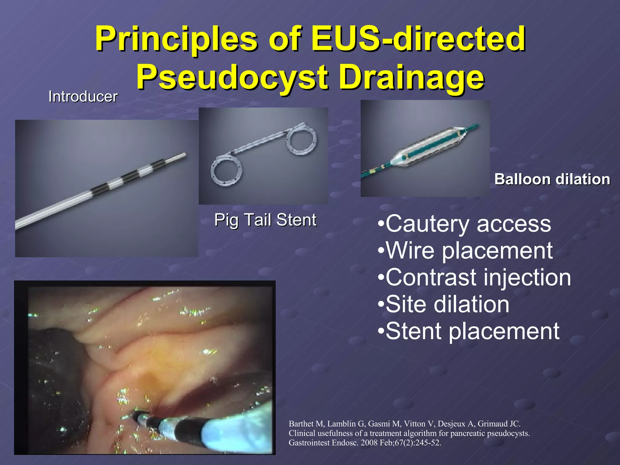 Therapeutic Eus 2008 | PPT