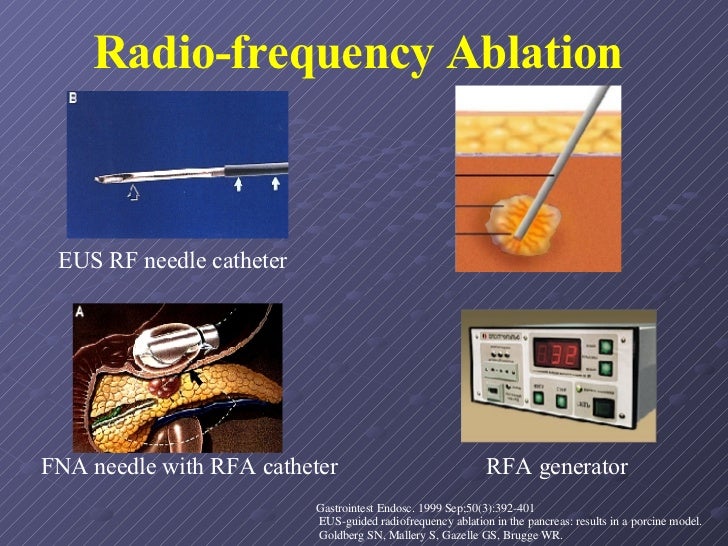Therapeutic Eus 2008