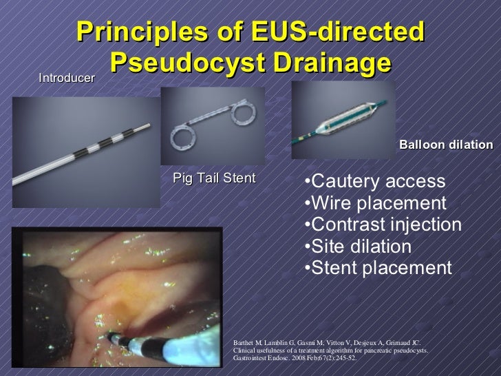 Therapeutic Eus 2008