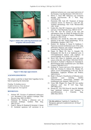 Therapeutic approach to epidermoid cyst | PDF