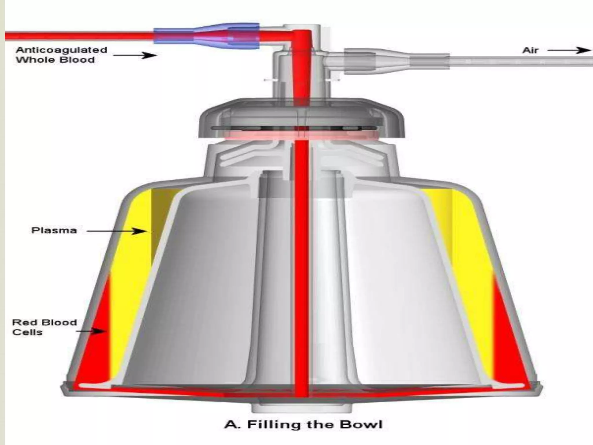 Therapeutic plasma exchange | PPTX