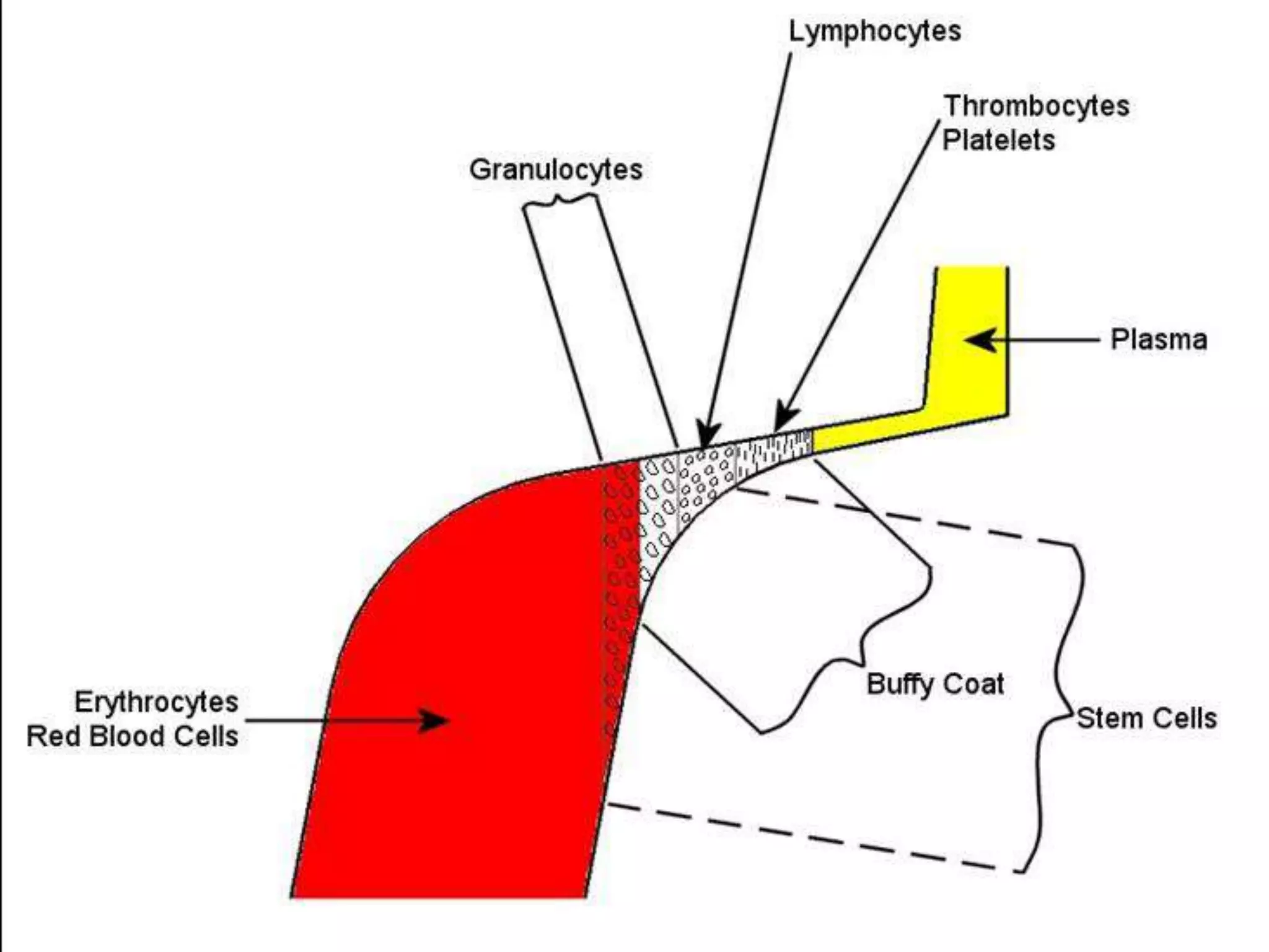Therapeutic plasma exchange | PPTX