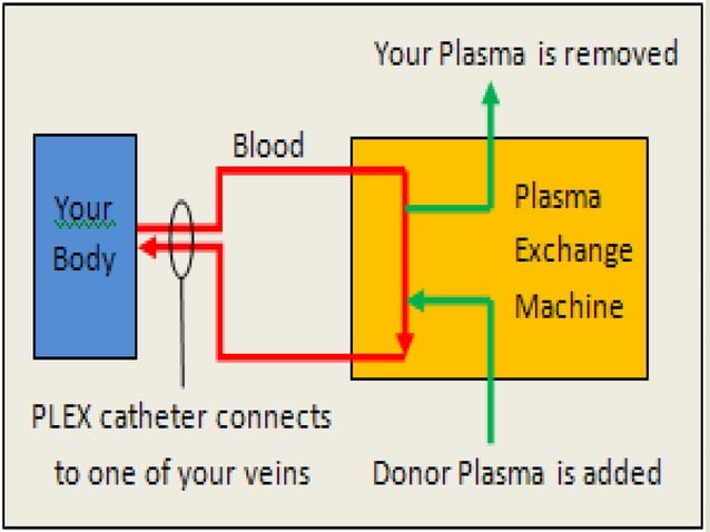 Therapeutic plasma exchange | PPTX | Blood Disorders | Diseases and ...