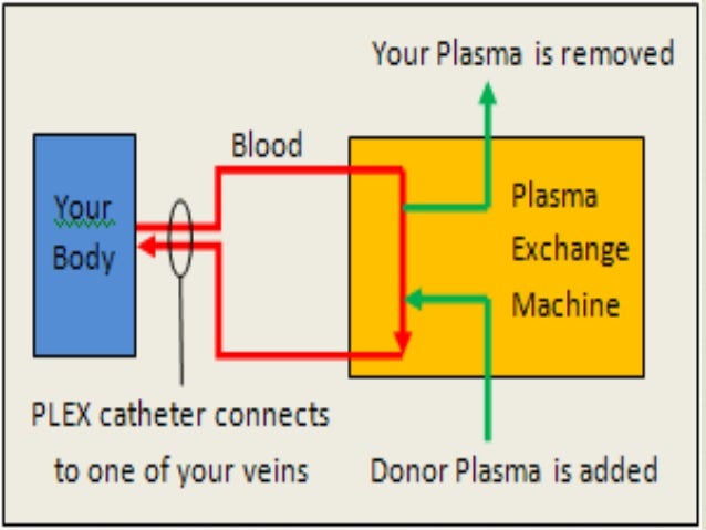 Therapeutic plasma exchange