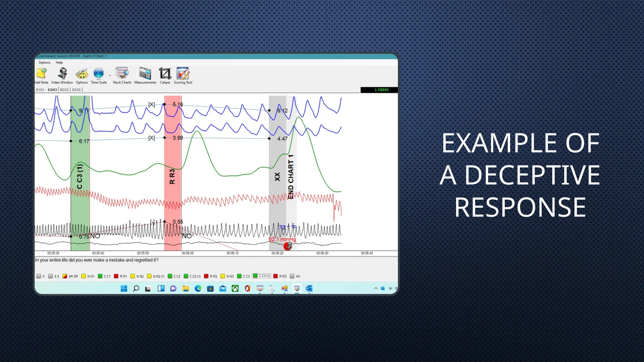 Therapeutic Polygraph Methodology. .pptx