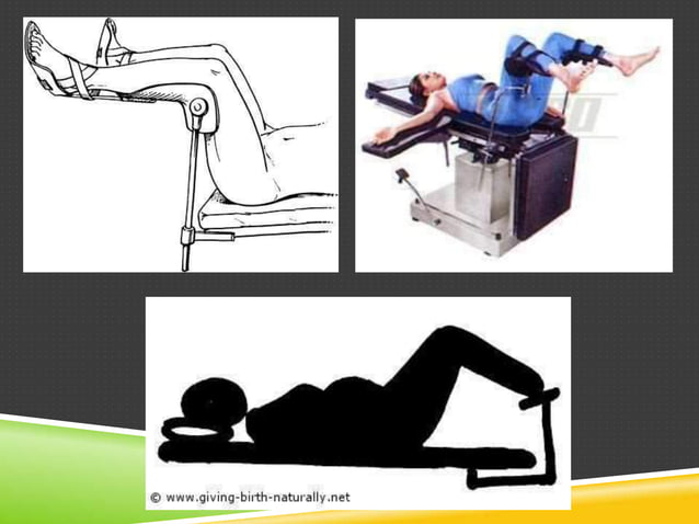 Therapeutic position compressed | PDF | Physical Therapy | Wellness