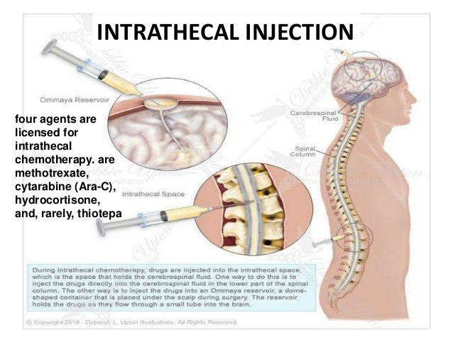 Therapeutic procedures