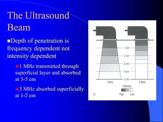 Therapeutic Ultrasound.pptx