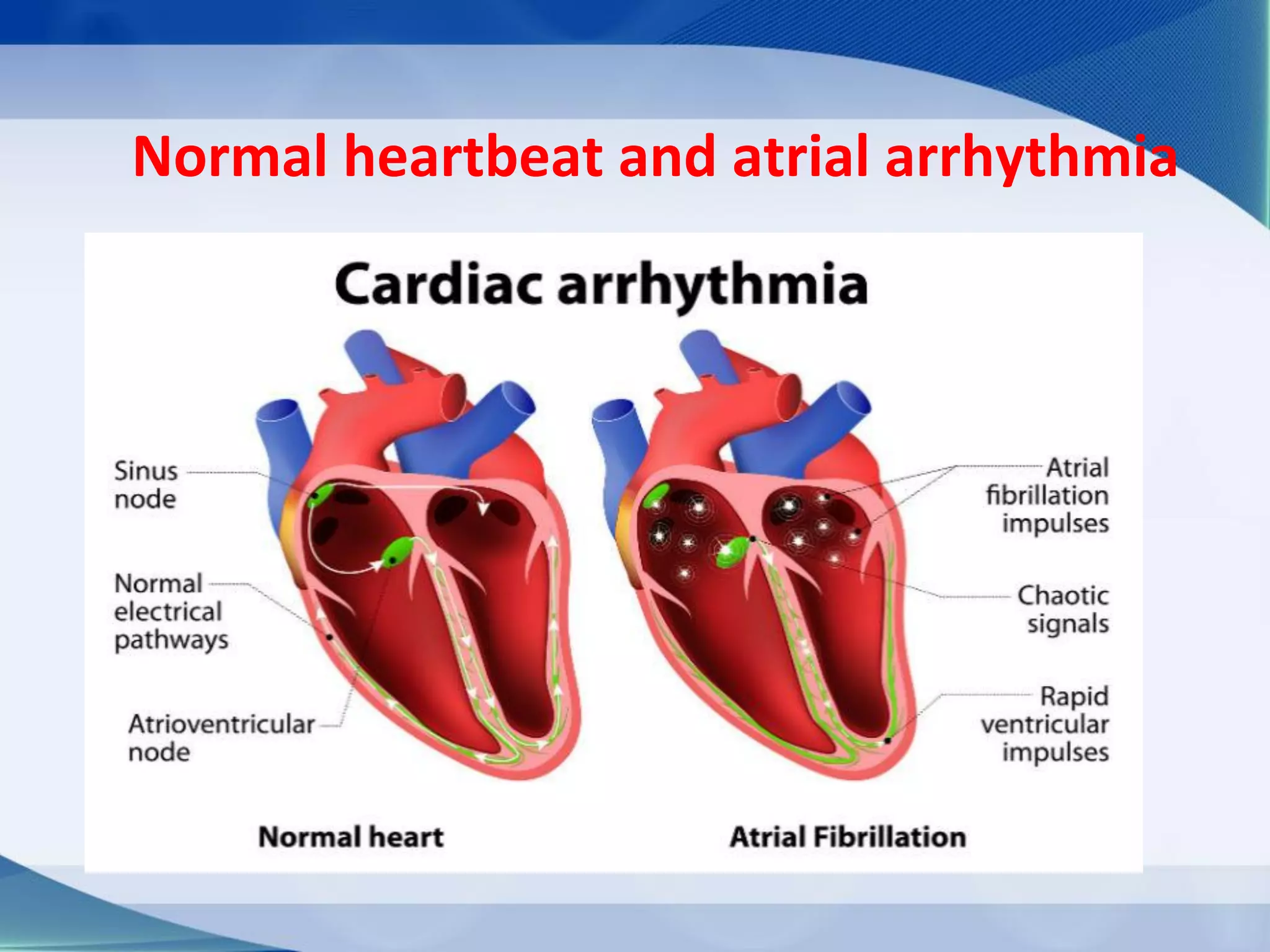 Antiarrhythmic drugs | PDF
