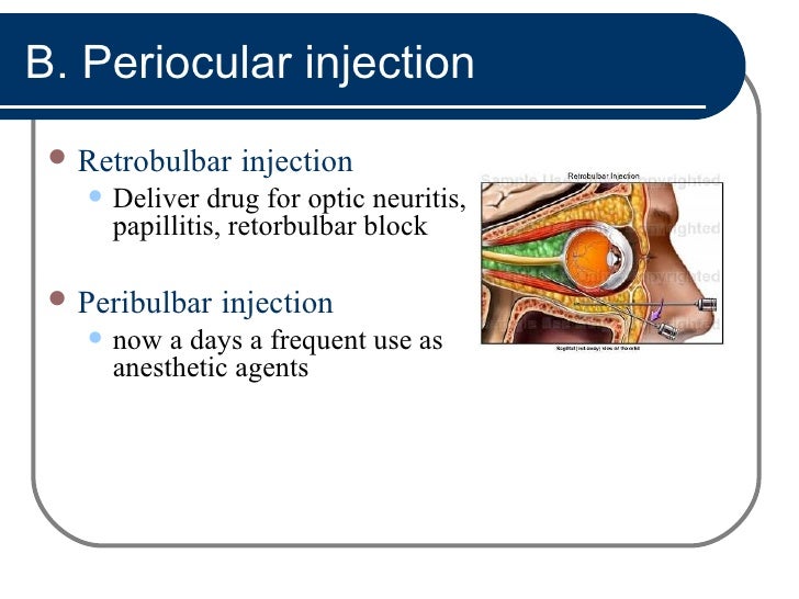 Therapies in ophthalmology