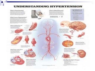 T herapy of hypertension1 | PPT