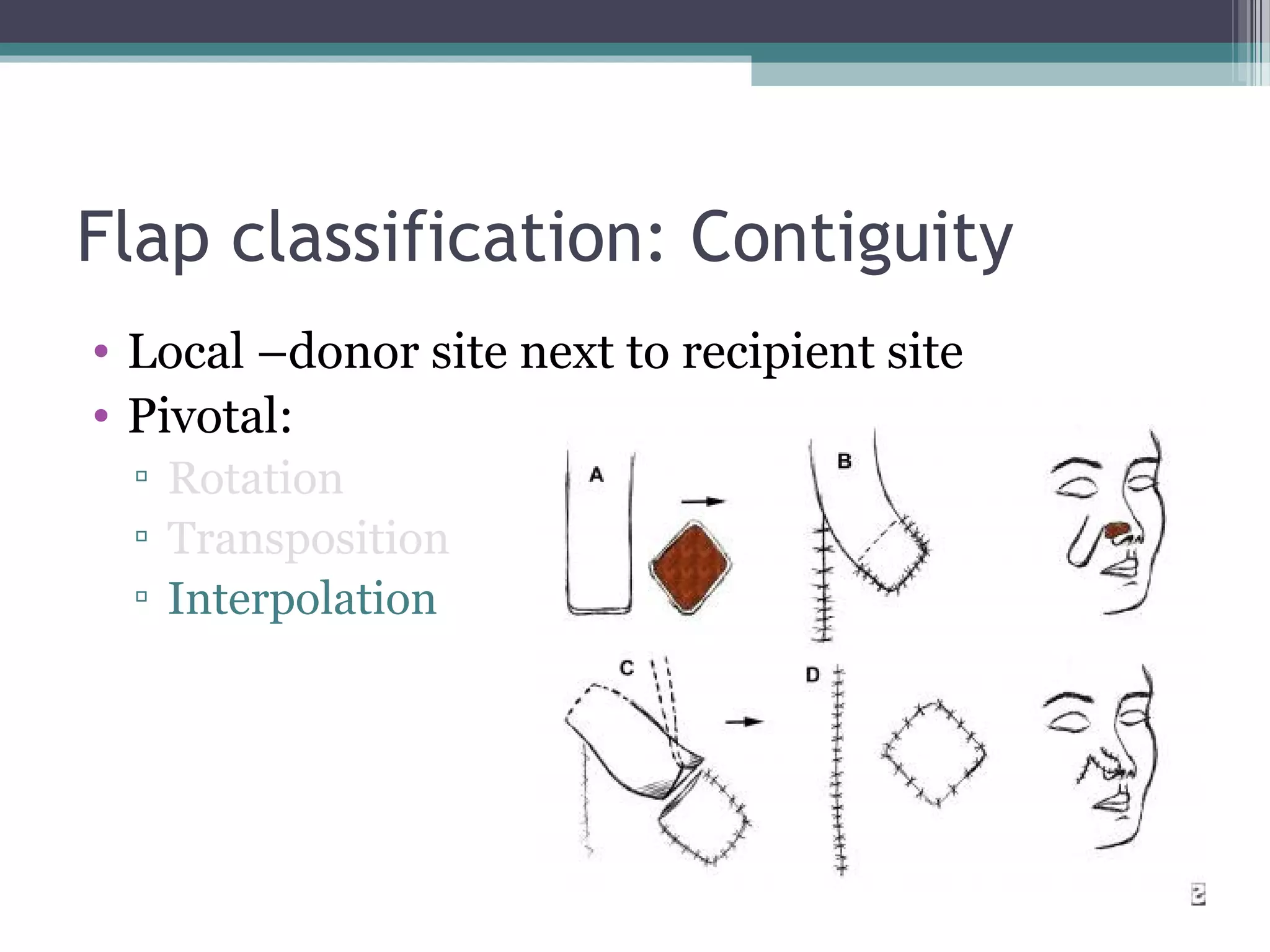 The Reconstructive Ladder - Mussa Mensa | PPT