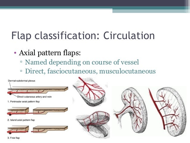 The Reconstructive Ladder - Mussa Mensa