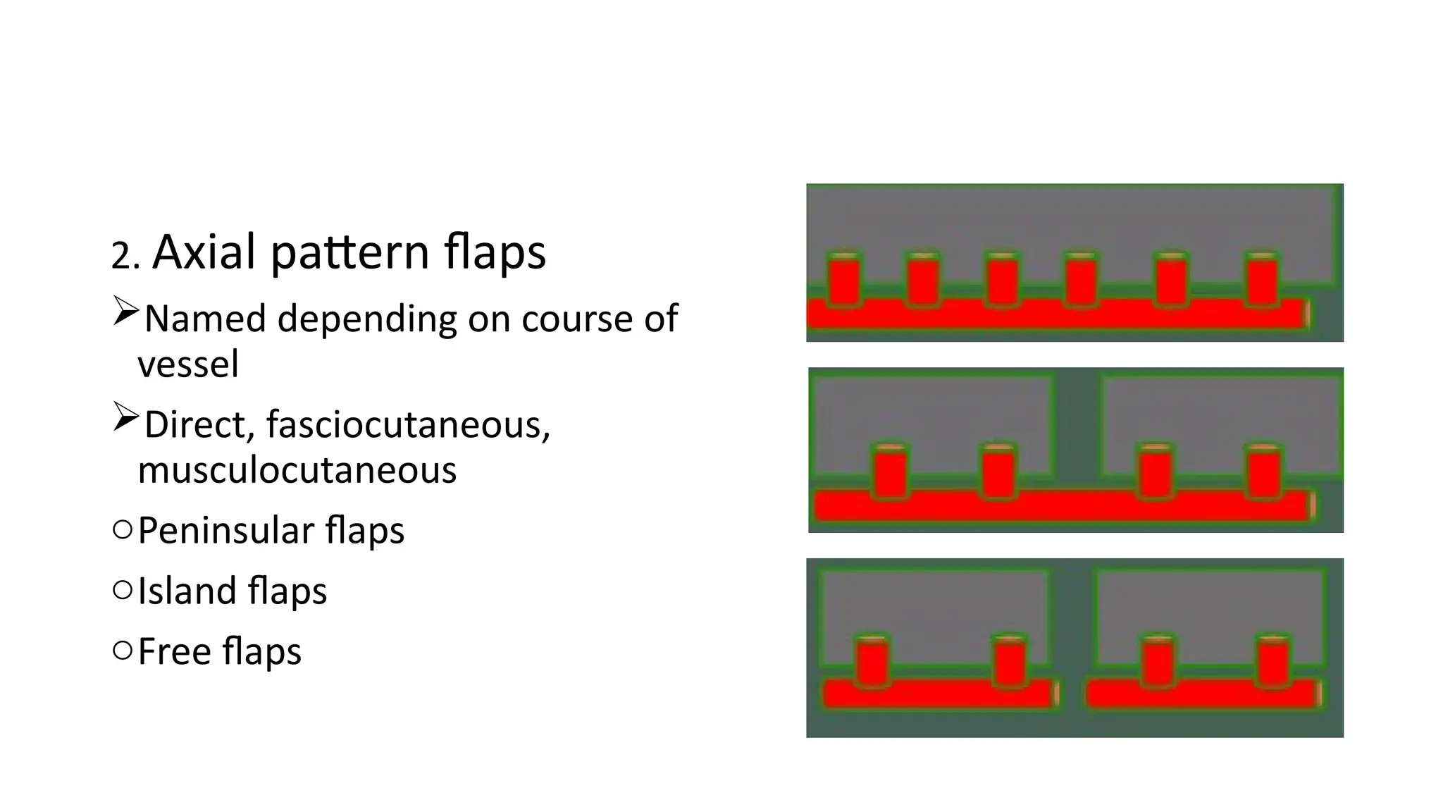 THE RECONSTRUCTIVE LADDER BY DR BINOD CHAUDHARY | PPTX