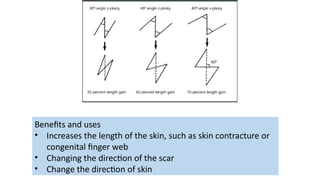 THE RECONSTRUCTIVE LADDER BY DR BINOD CHAUDHARY | PPTX
