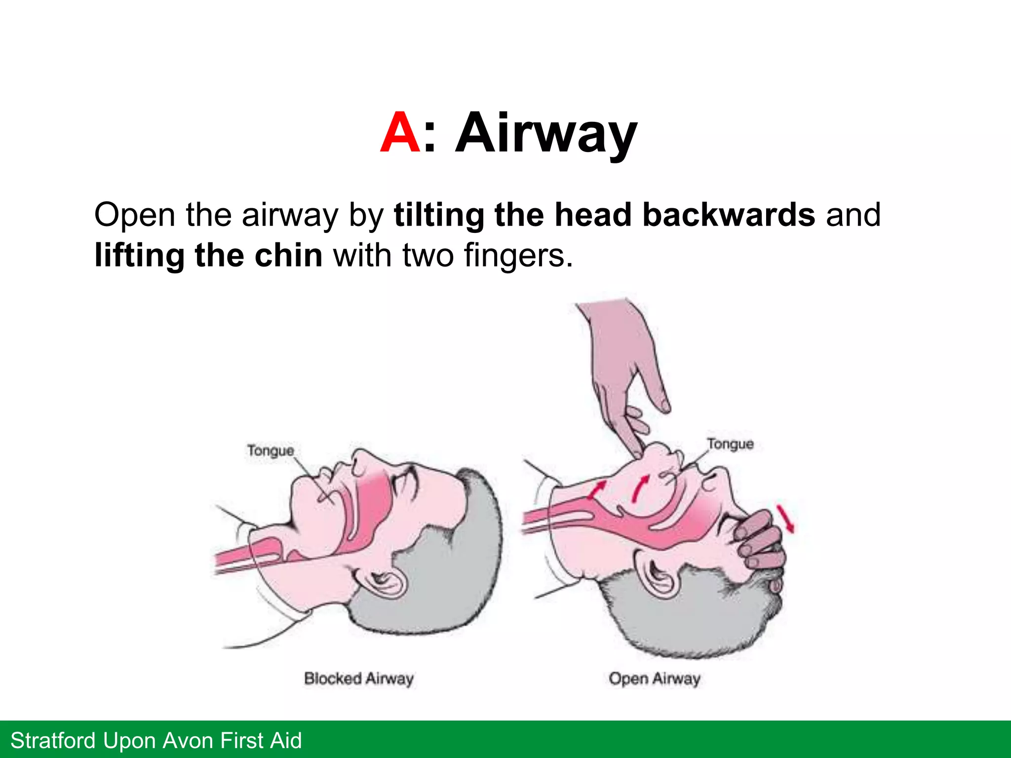 The recovery position | PPTX