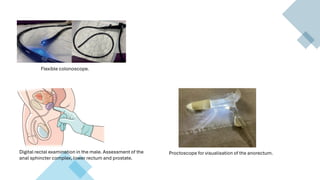 The rectum – anatomy, clinical features of human | PDF