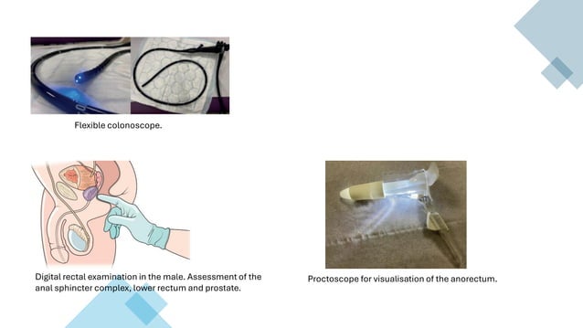 The rectum – anatomy, clinical features of human | PPT