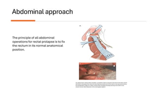 The rectum – anatomy, clinical features of human | PPT