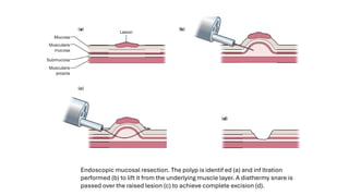 The rectum – anatomy, clinical features of human | PPT